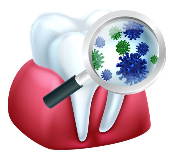Risk Factors for Periodontal Disease - Silver Spring, MD Dentists